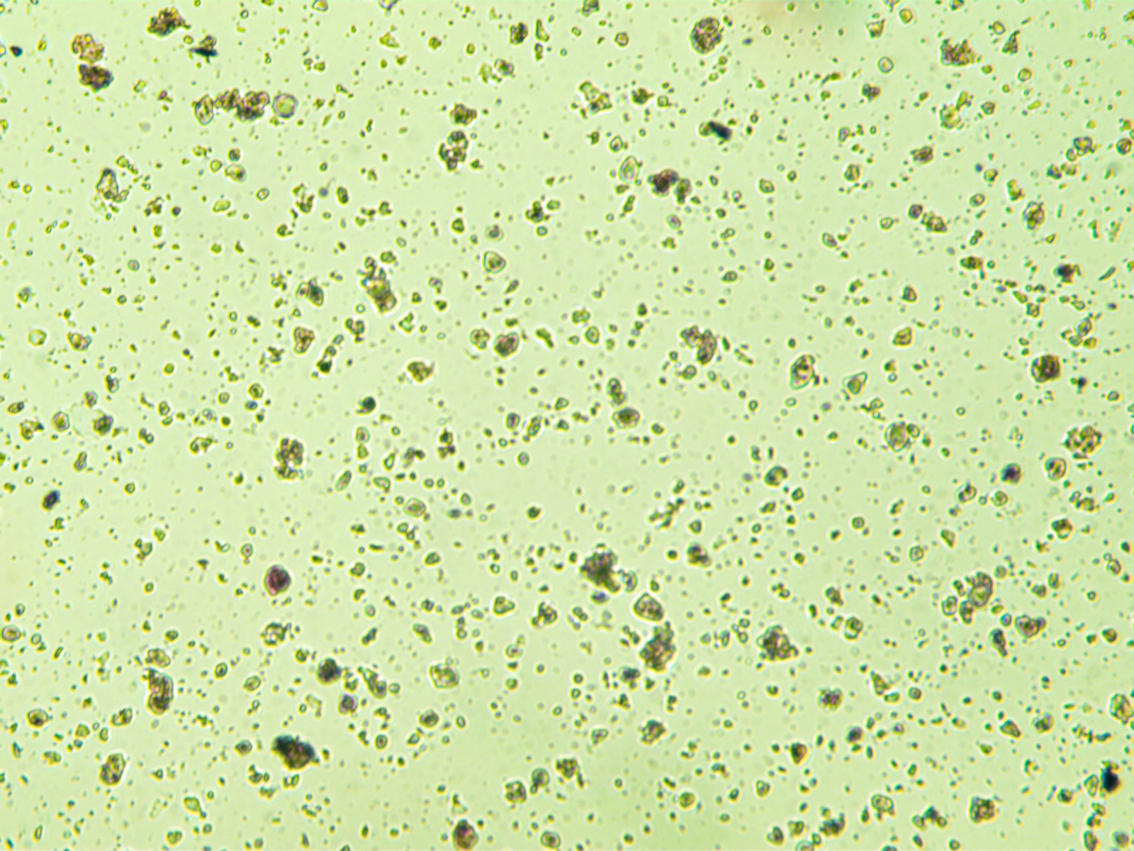Microbes Matter: Understanding Soil Biology Through Nature's Brew ...